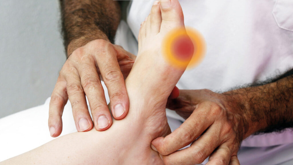 Was ist eine Kapsulitis? - Kraftort Therapiezentrum