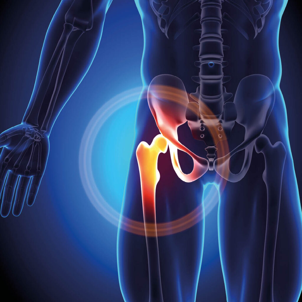 Was ist eine Kapsulitis? - Kraftort Therapiezentrum