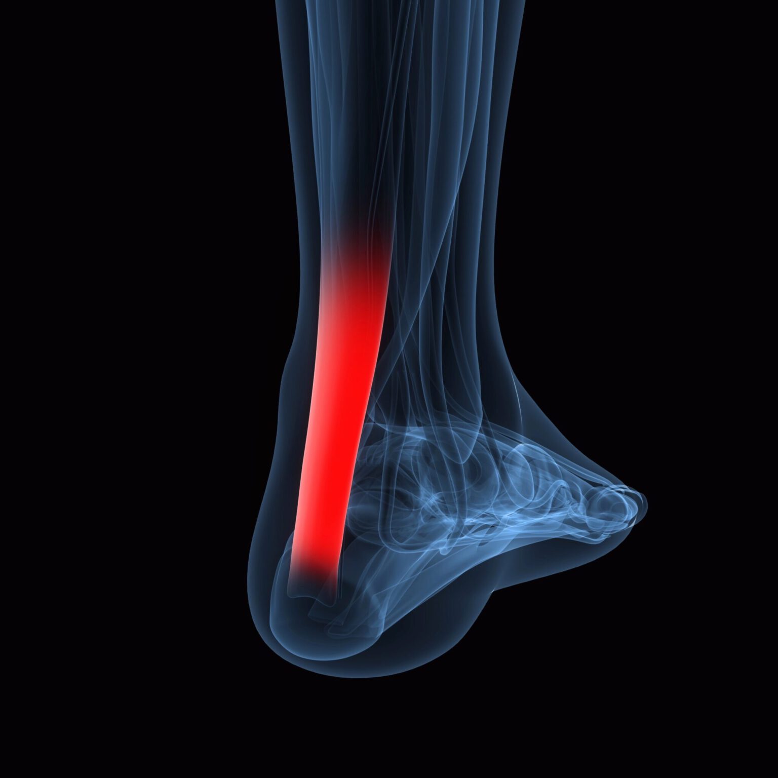 Was ist eine Kapsulitis? - Kraftort Therapiezentrum